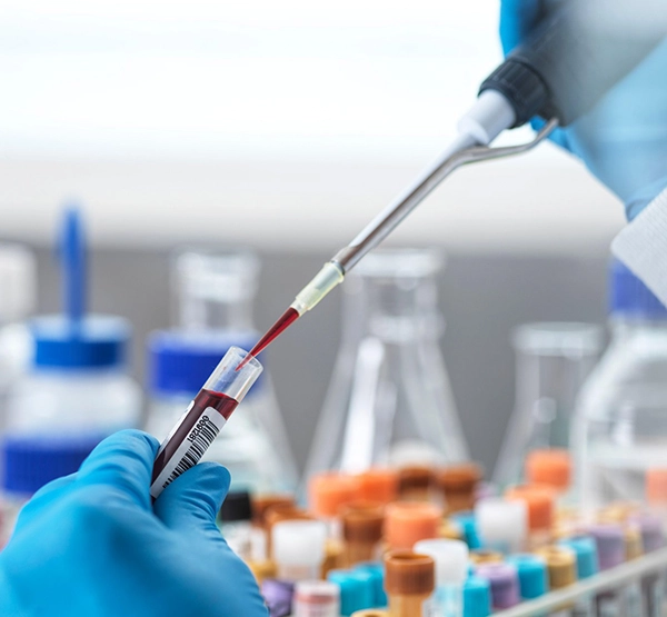 The benefits of using outsourced DNA Extraction Services. - AutoGen, Inc.